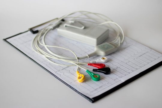 Revolucionarni Holter EKG monitoring | Otkrijte tajne vašeg srca